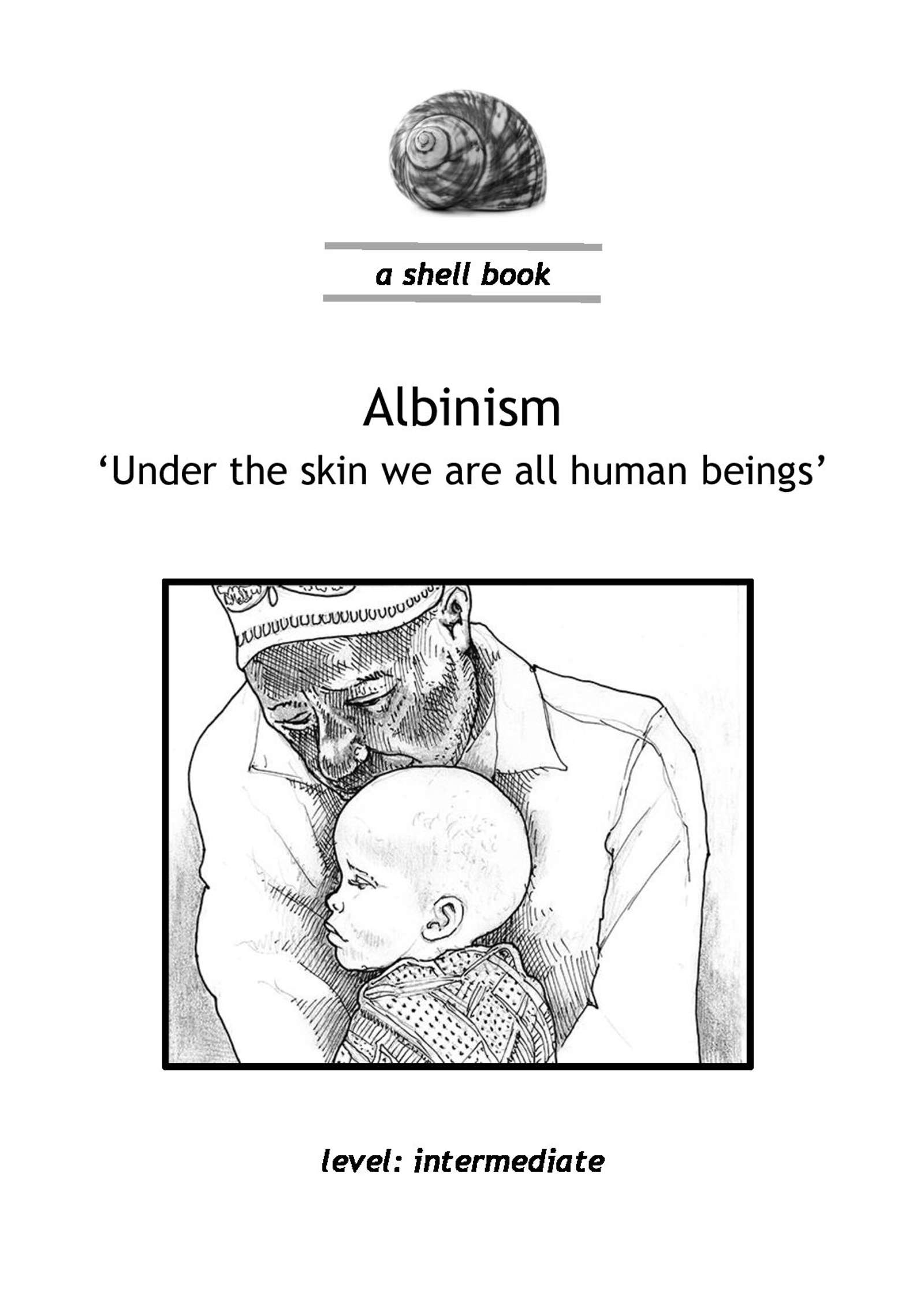 Ocular Albinism Symptoms Types Genetics And Treatment